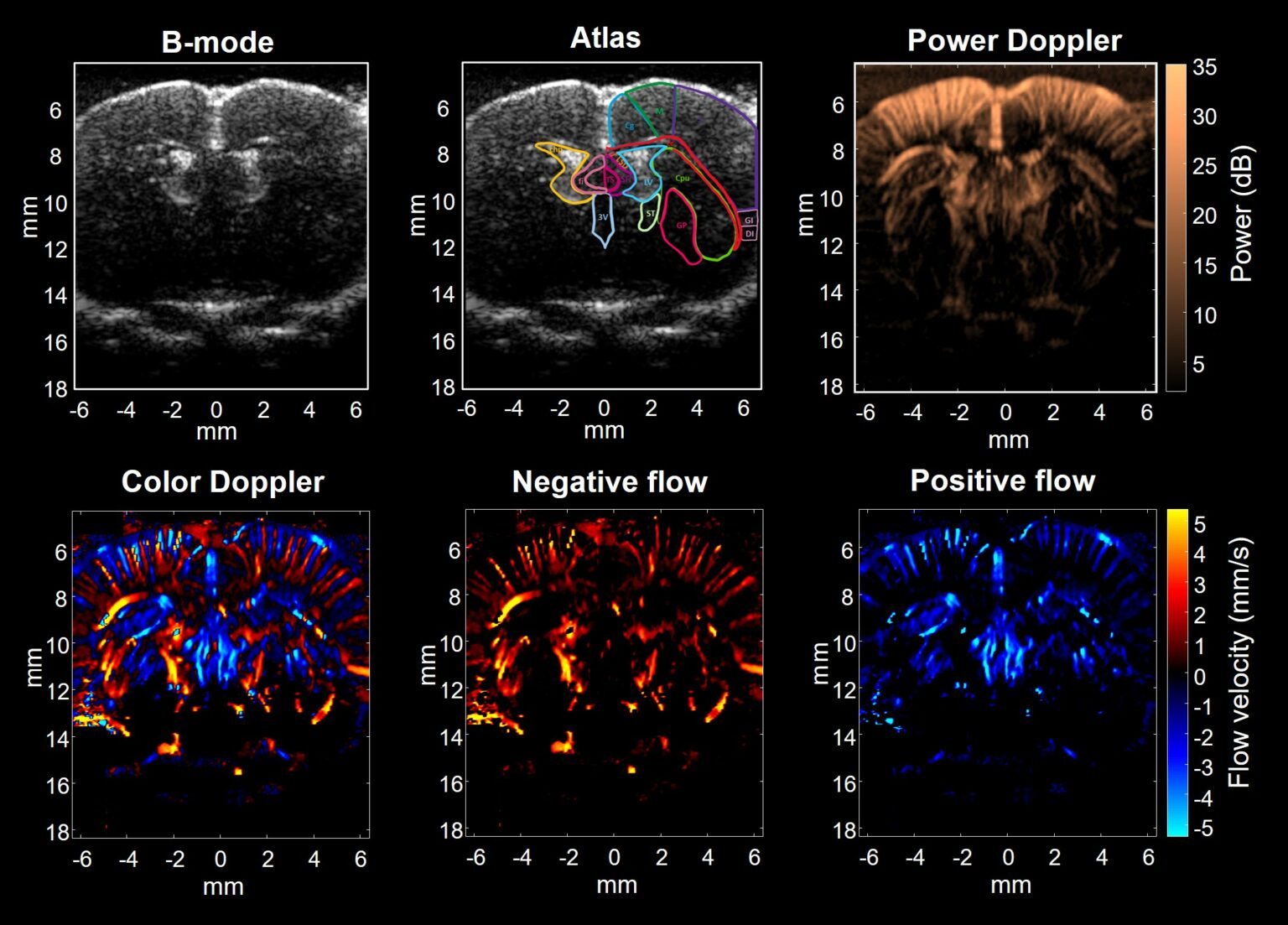 Research – Photoacoustic and Ultrasound Imaging Laboratory